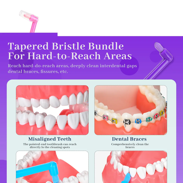 Монопучкова зубна щітка Lerch для брекетів, 2 шт. – купити онлайн на ...