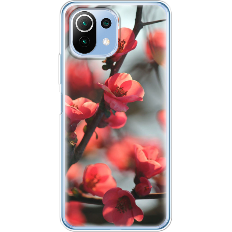 Силиконовый чехол BoxFace Xiaomi 11 Lite 5G NE Awakening Spring (43700 ...
